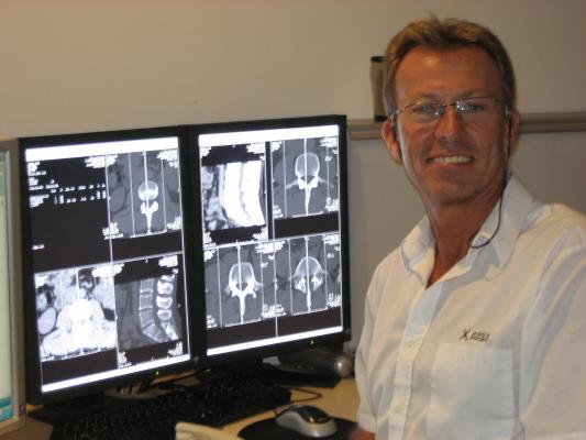 Osteoporosis: It’s no humerus matter | Seniors Today